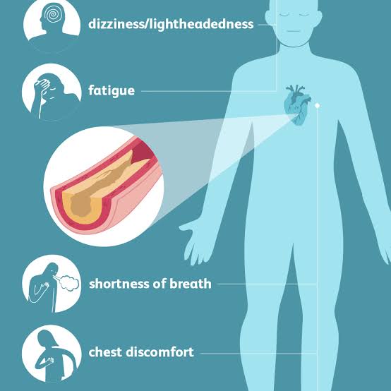 Cardiovascular Disease Prediction Using Risk Fectors
